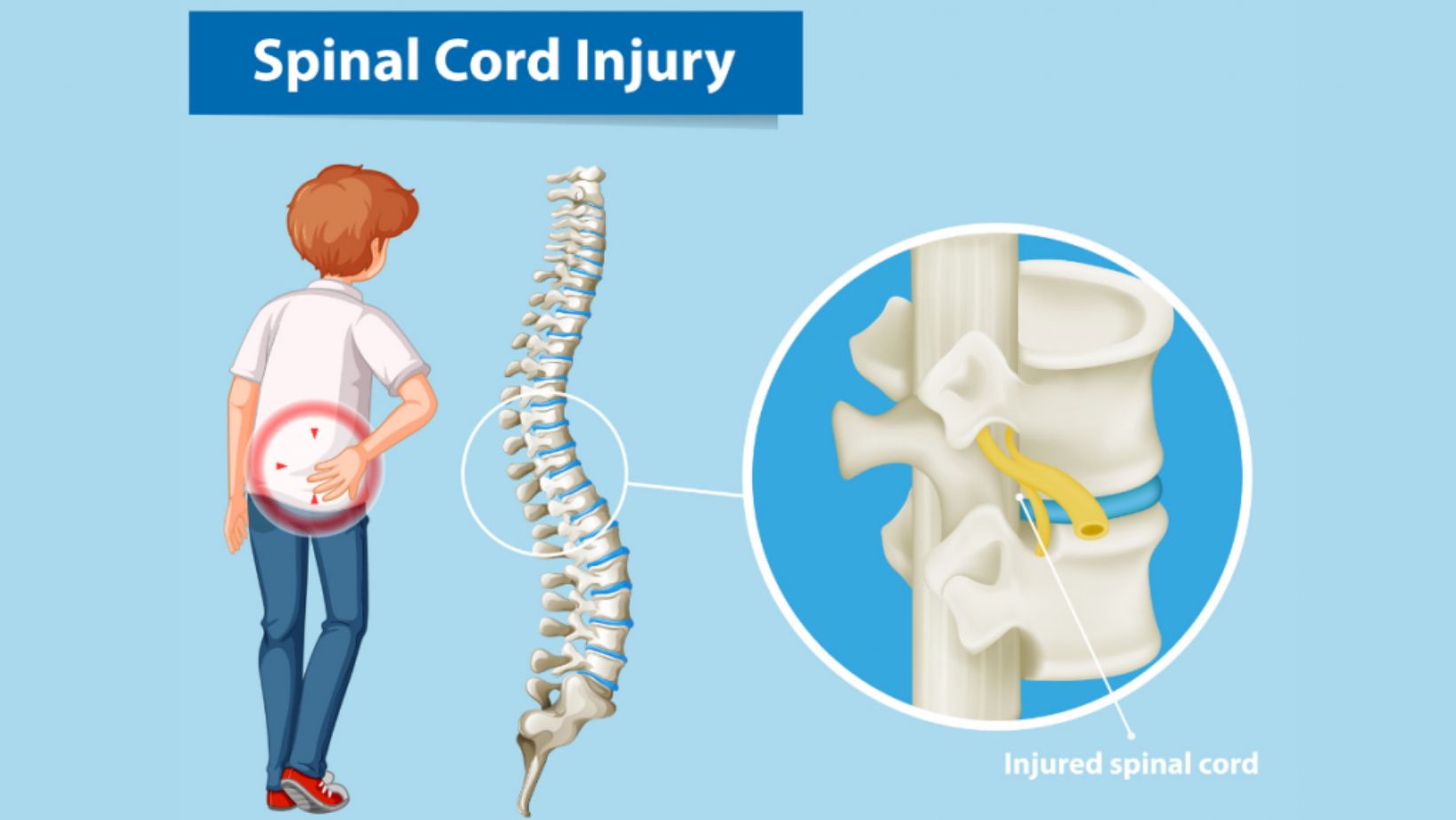 Common Causes of Spinal Cord Injuries You Should Know About ...